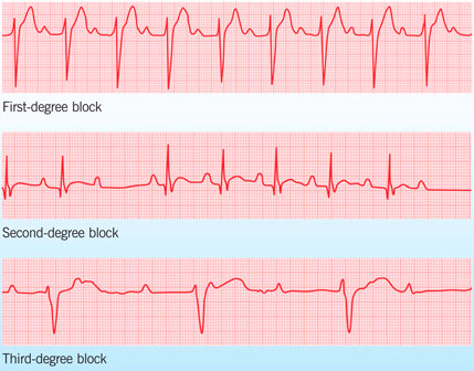 Ecg Part 1
