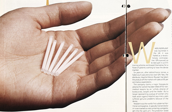 Levonorgestrel Implants - Pictures