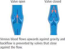 Picc Line Vs Midline Catheter Nursing Pinterest