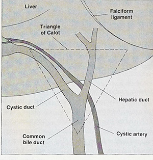 Calot's Triangle Diagram