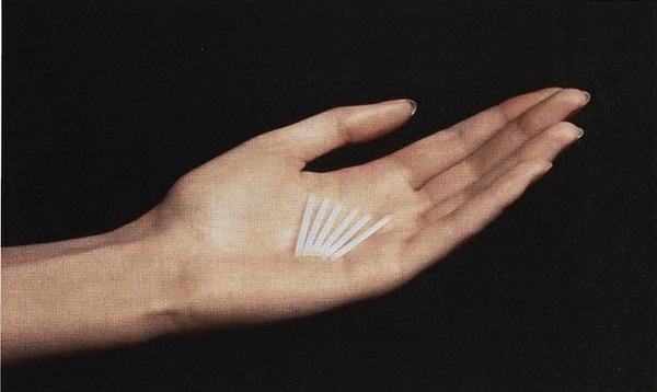 Norplant Birth Control Implants Nexplanon Vs. Mirena: Differences,