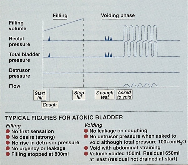 Urine Void Chart