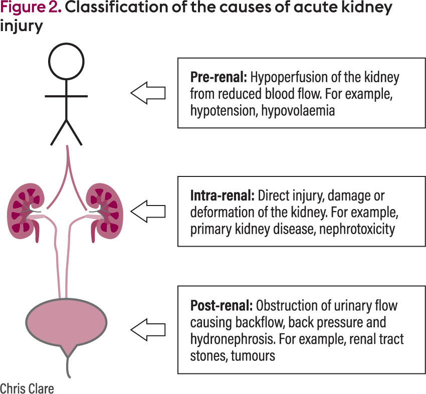 Acute Kidney Injury Classification Using Three Prifle