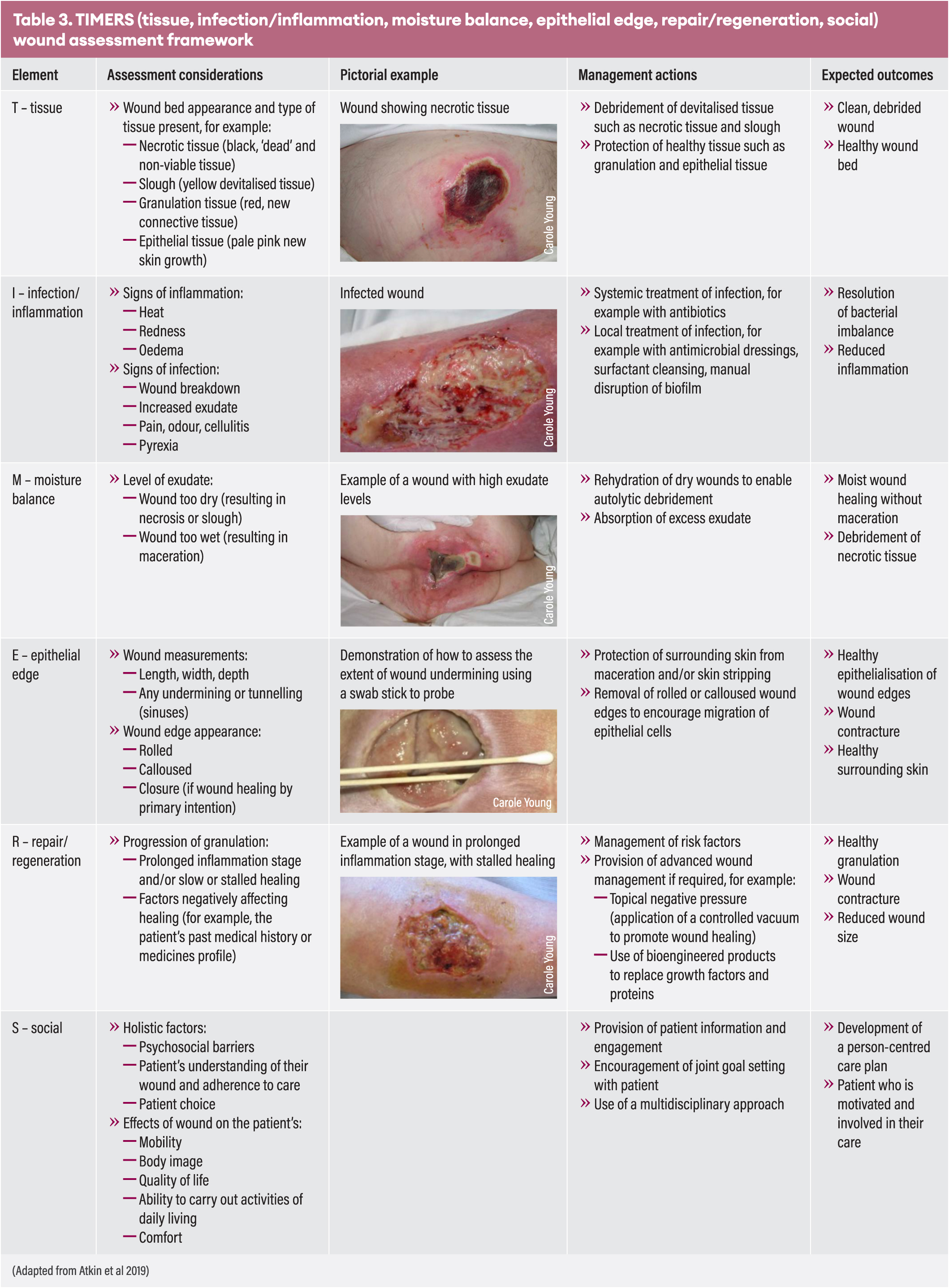 Wound Drainage Assessment Wound Exudate Assessment And Management